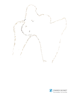 Comprehensive® Total Shoulder System