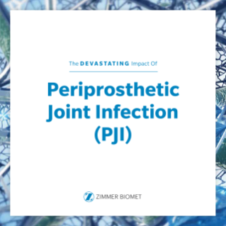 Bactisure® Wound Lavage | Zimmer Biomet