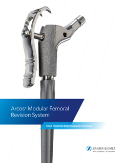 Arcos Modular Femoral Revision System | Hip Replacement Implant