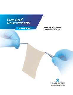 Soft Tissue Management | DermaSpan™ Acellular Dermal Matrix | Zimmer Biomet