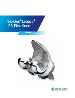 NexGen Complete Knee Solution | LPS-Flex Fixed Bearing Knee Implant