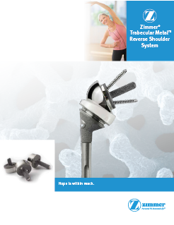 Reverse Shoulder | Trabecular Metal Reverse Shoulder System | Zimmer Biomet