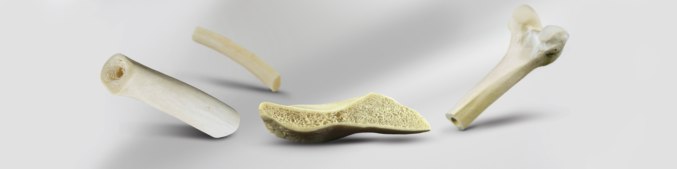 Allograft|Tissue|Bone