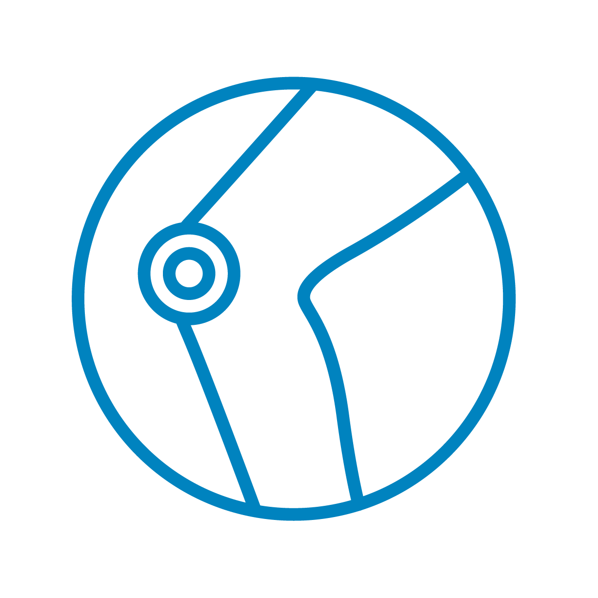 Gel-One® Cross-linked Hyaluronate