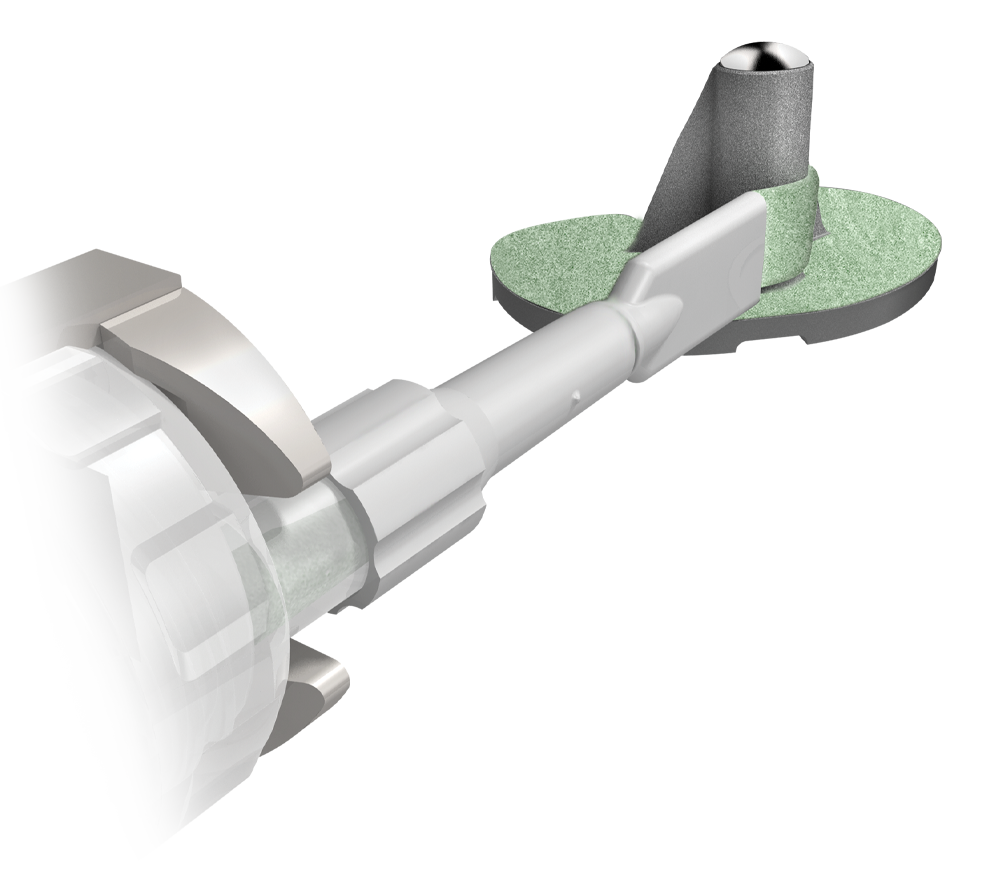 Modern Cementing Technique | Zimmer Biomet
