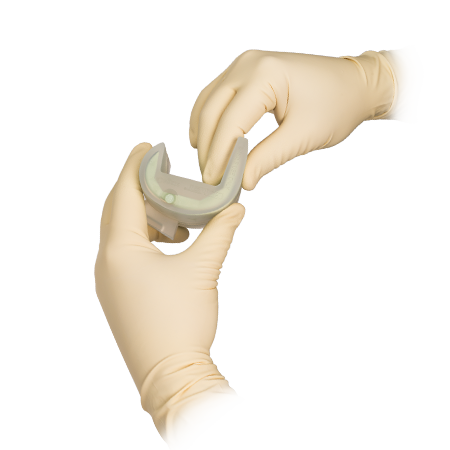 StageOne Cement Spacer Molds | Two Stage Revision Arthroplasty