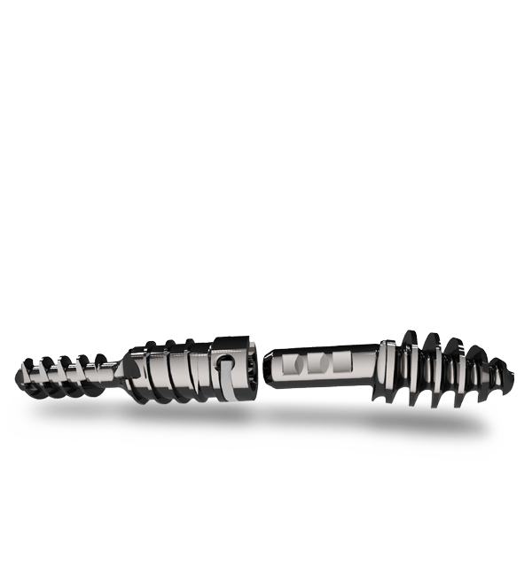 Nextra® Hammertoe Correction System | Zimmer Biomet