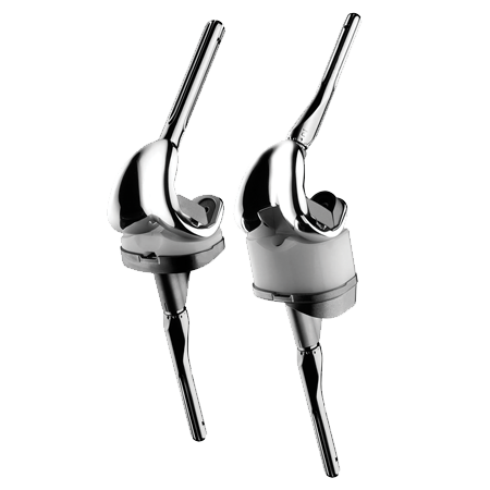 NexGen® Legacy® Constrained Condylar Knee (LCCK)