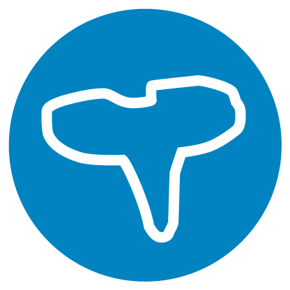 Persona OsseoTi Keel Tibia: Cementless Total Knee Arthroplasty