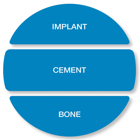 Persona® Revision Knee