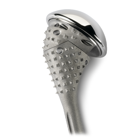 Shoulder Replacement Products | Zimmer Biomet