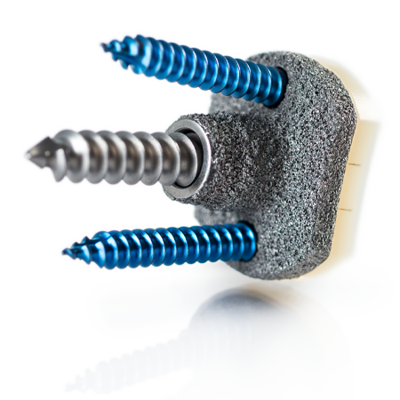 Shoulder Replacement Products | Zimmer Biomet