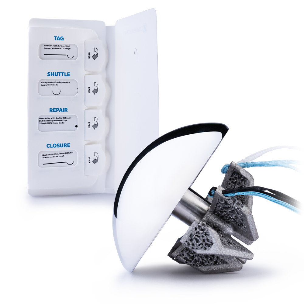 OsseoFit™ Stemless Shoulder System | Zimmer Biomet