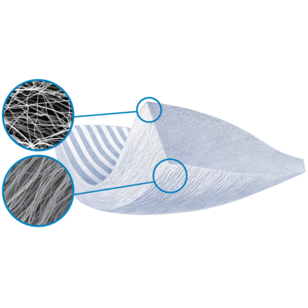 Tapestry® RC Biointegrative Implant System