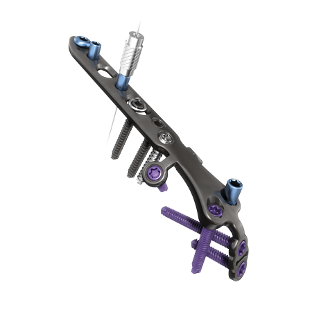 Trauma Products | Zimmer Biomet