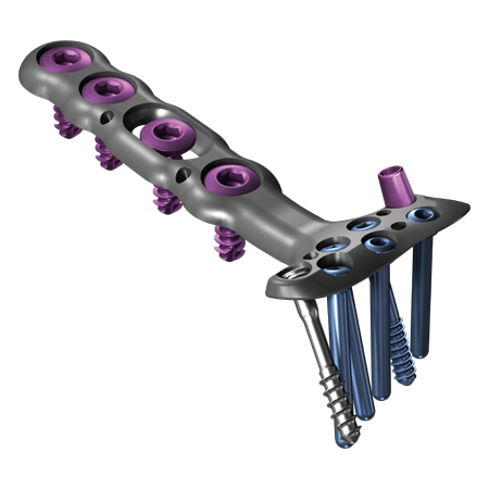 Trauma Products | Zimmer Biomet