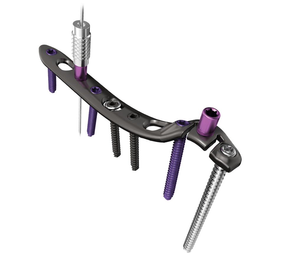 A.L.P.S® Elbow Fracture System