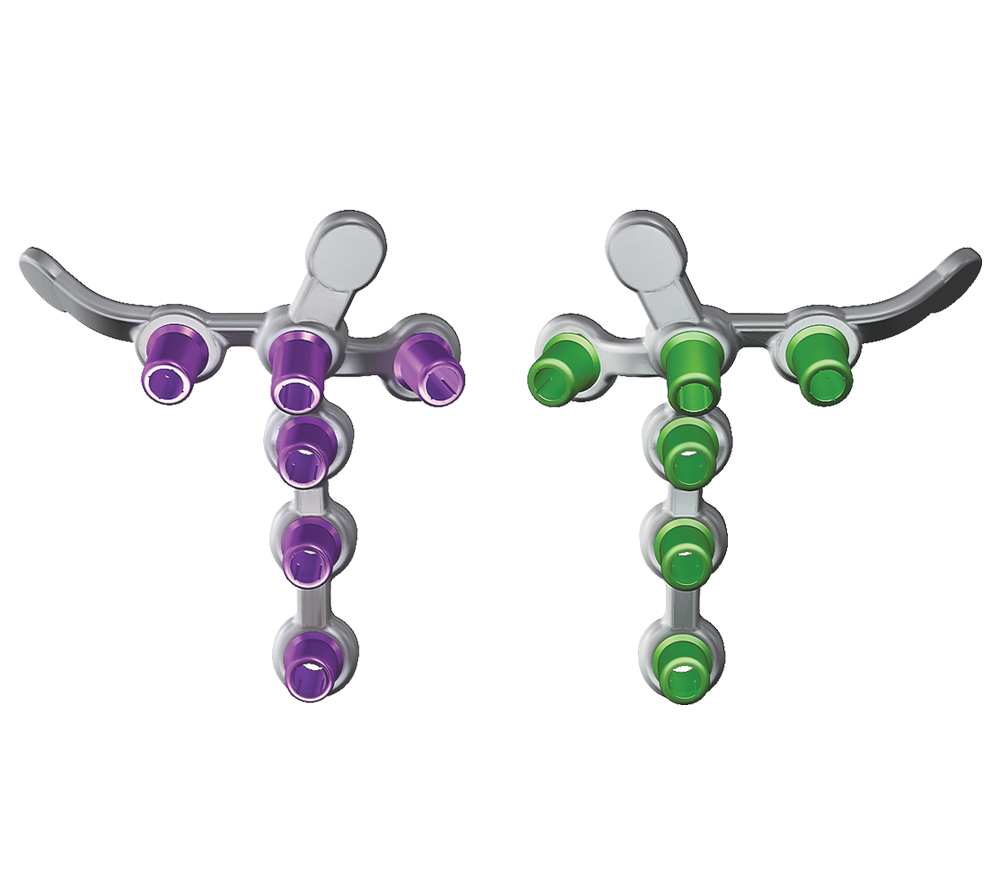 A.L.P.S® Elbow Fracture System