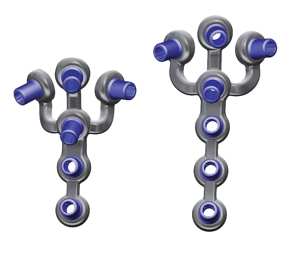 A.L.P.S® Elbow Fracture System