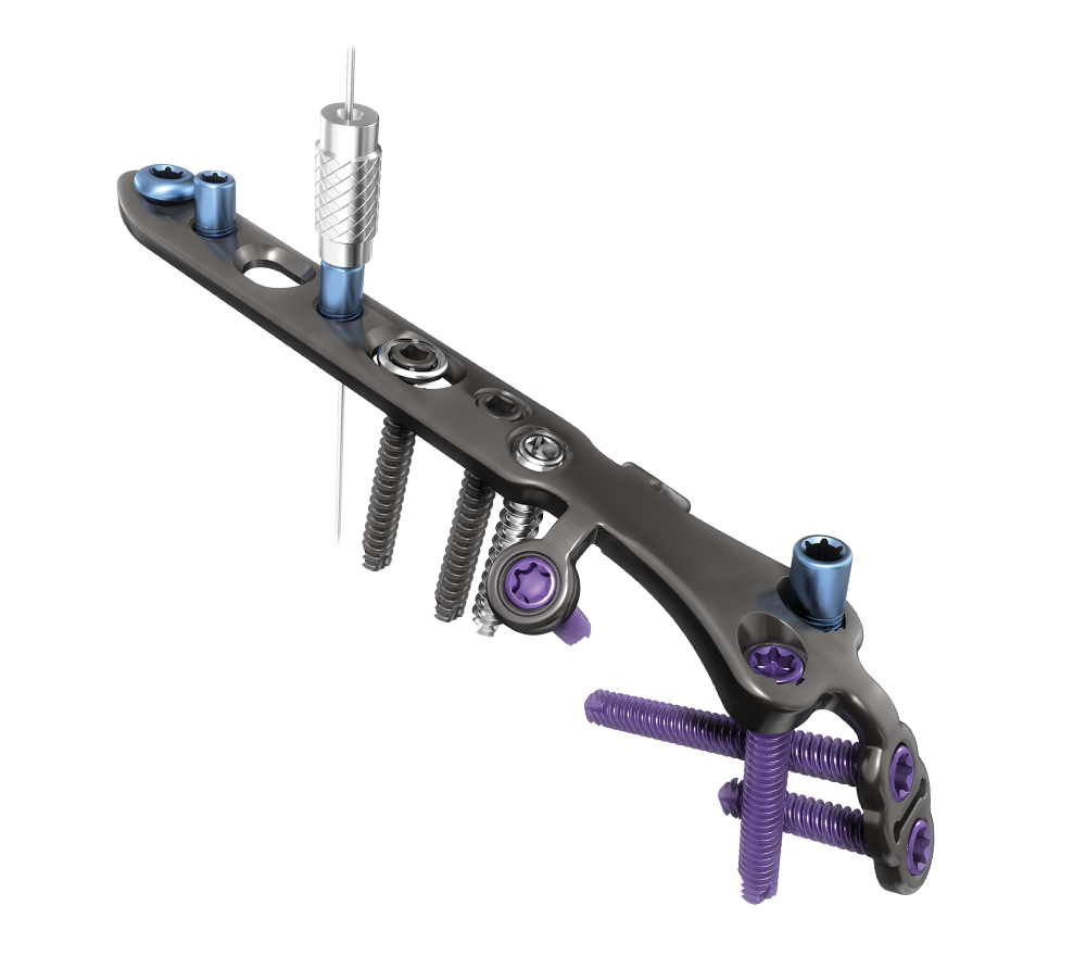 A.L.P.S® Elbow Fracture System