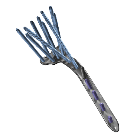 A.L.P.S® Proximal Tibia Plating System