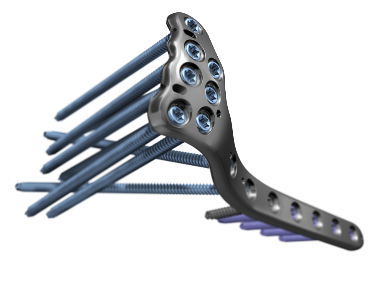 proximal tibia locking plate