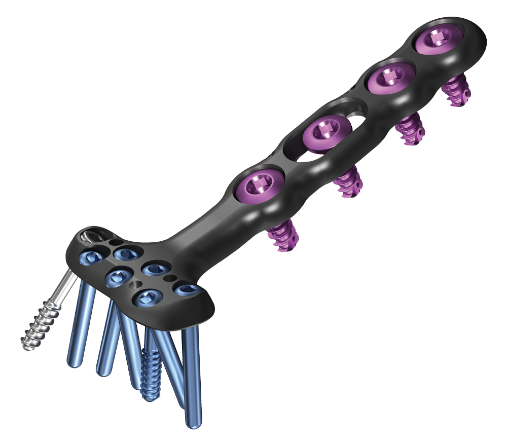 DVR® Plating System | Zimmer Biomet