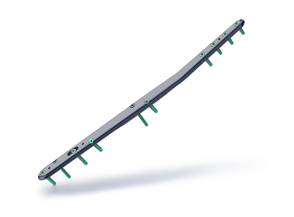 DVR Wrist Spanning Plating System